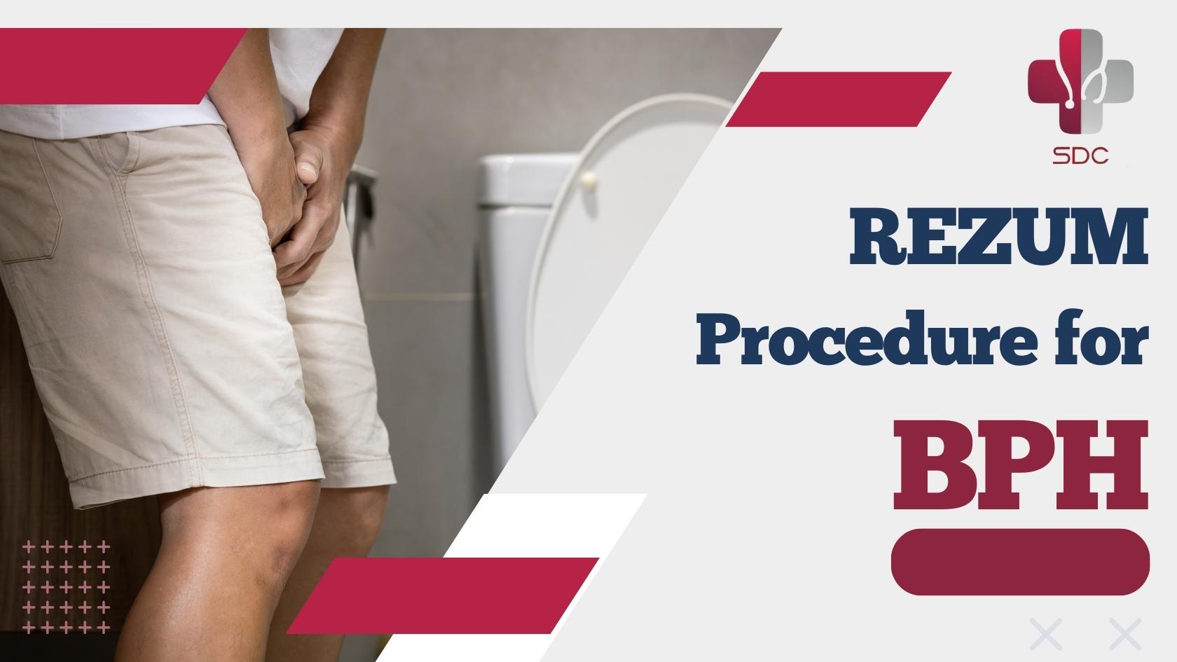 REZUM Procedure for BPH - sdcprostatecentre.com