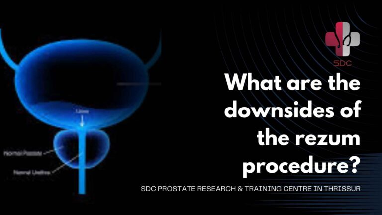 What Are the Downsides of the Rezum Procedure? - sdcprostatecentre.com