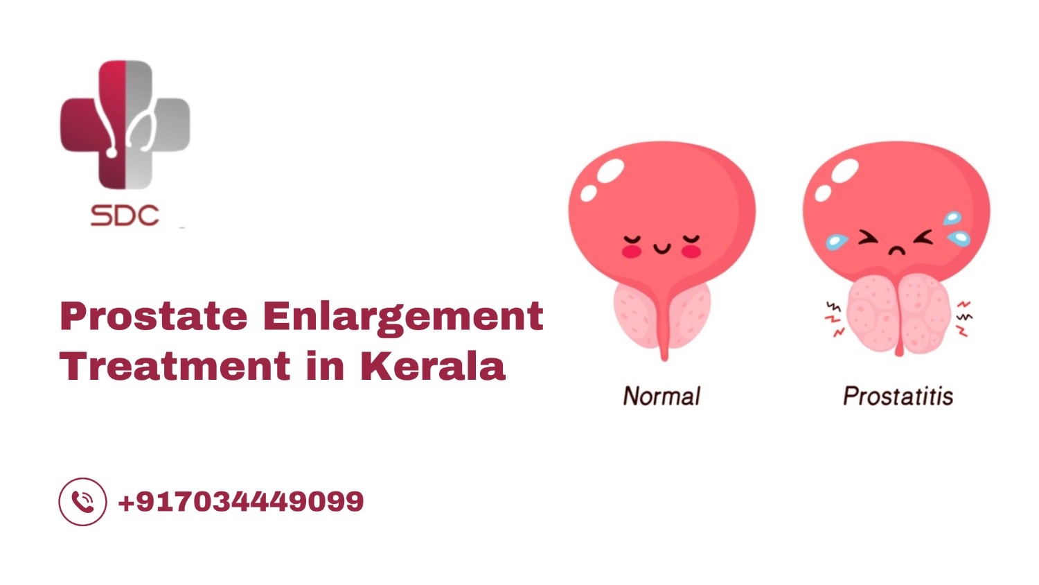 Prostate Enlargement Treatment in Kerala – sdcprostatecentre.com